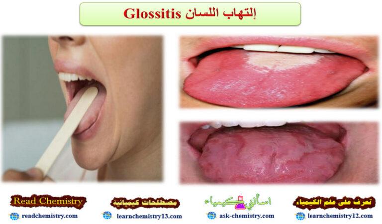 إلتهاب اللسان (Glossitis (tongue Inflammation | تعرف على علم الكيمياء